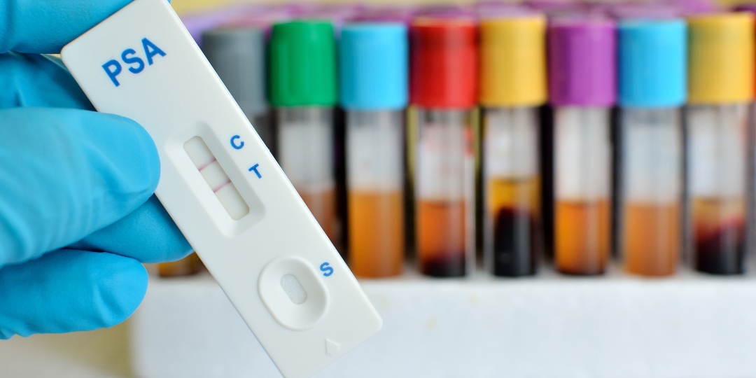A importância do exame de PSA no diagnóstico do câncer de próstata ...