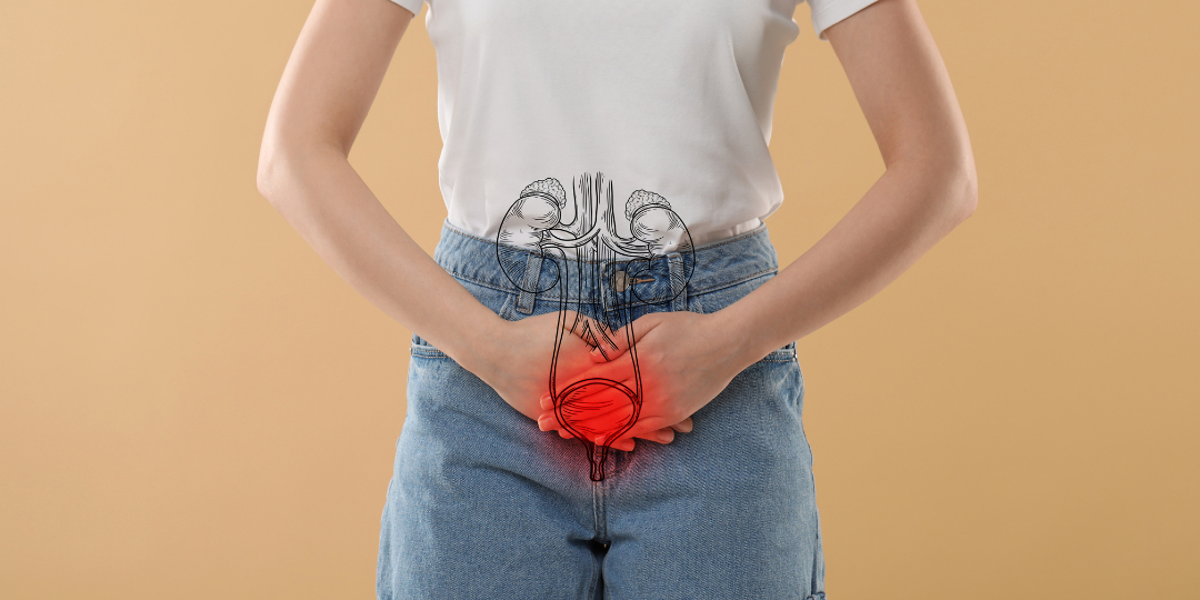 Cistite: causas, sintomas e como tratar corretamente - Urologia Vida